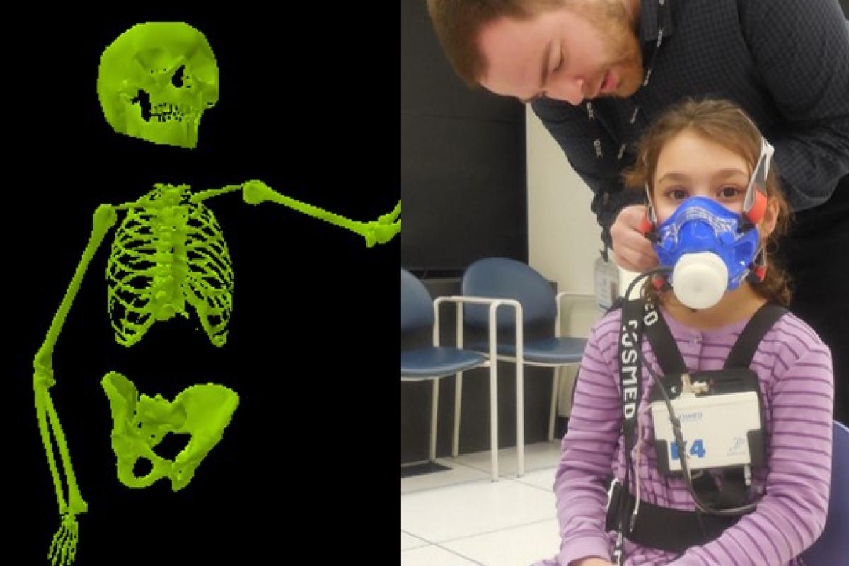 Computerized Motion Analysis